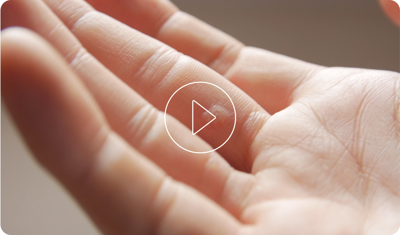 How Our Procedure Resolves Benign Skin Lesions | CellFX